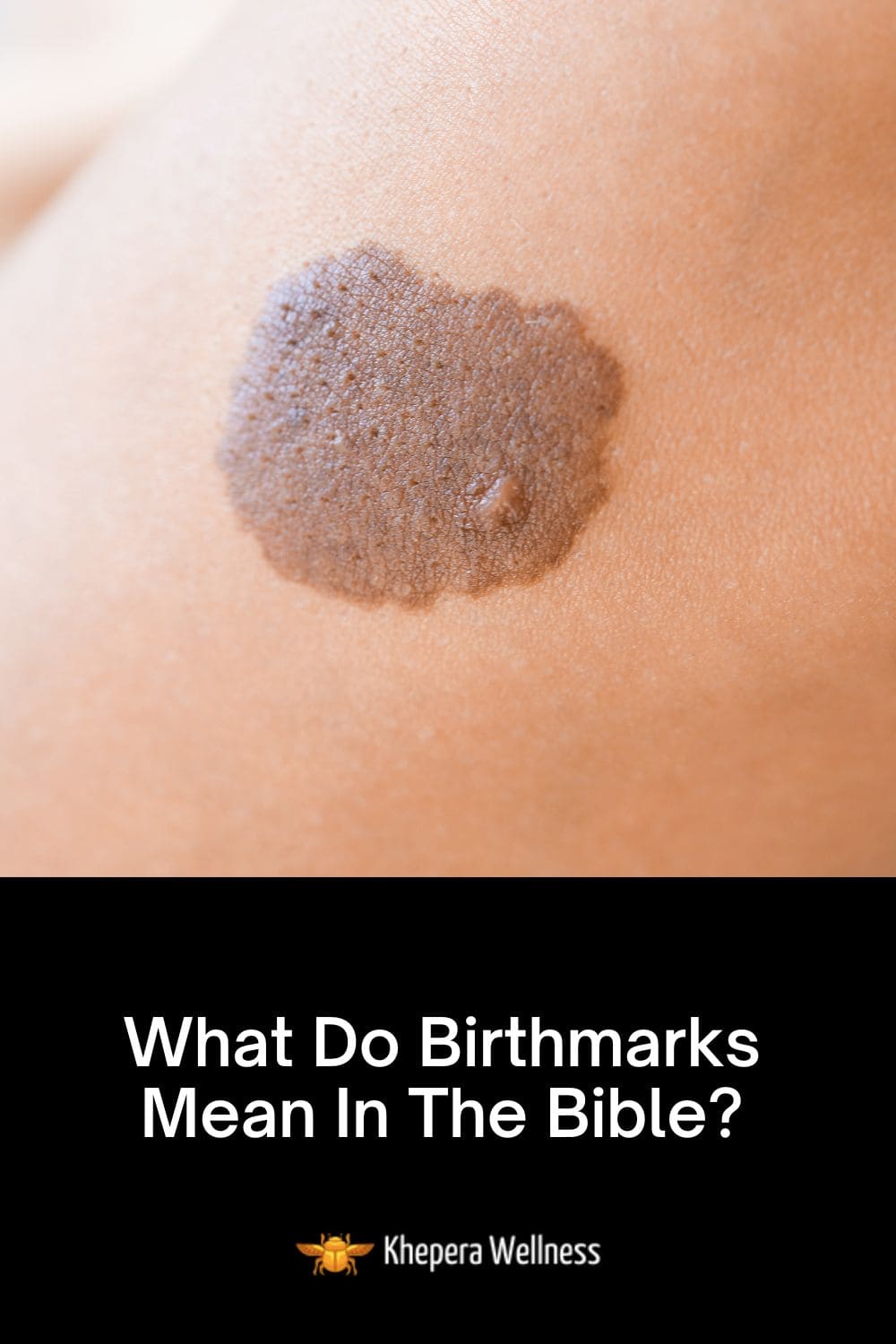 What Do Birthmarks Mean In The Bible? - Khepera Wellness