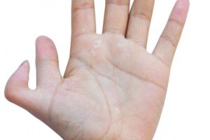 11 Spiritual Meanings Of Six Fingers (And good luck?)